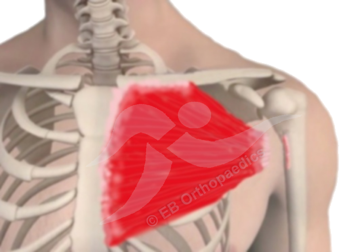 Orthopaedic & Trauma Surgeon - Shoulder - Pectoralis major rupture