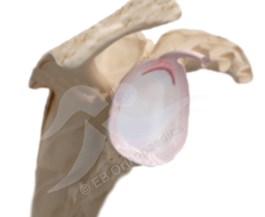 Orthopaedic & Trauma Surgeon - Shoulder - SLAP tears