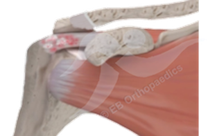 Physiotherapy Leaflets