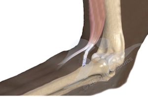 Physiotherapy Leaflets