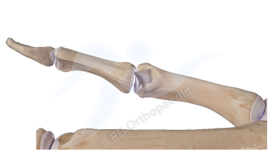 Physiotherapy Leaflets